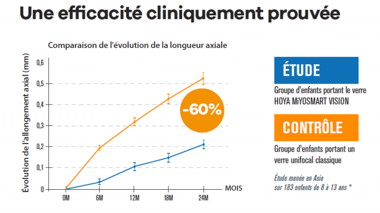 MYOPIE ENFANT : freiner son développement avec HOYA SMART